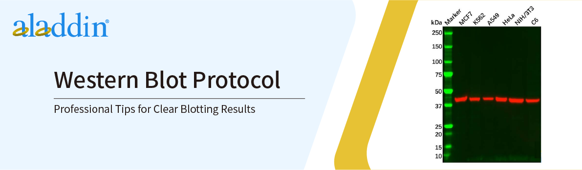 Western Blot Protocol